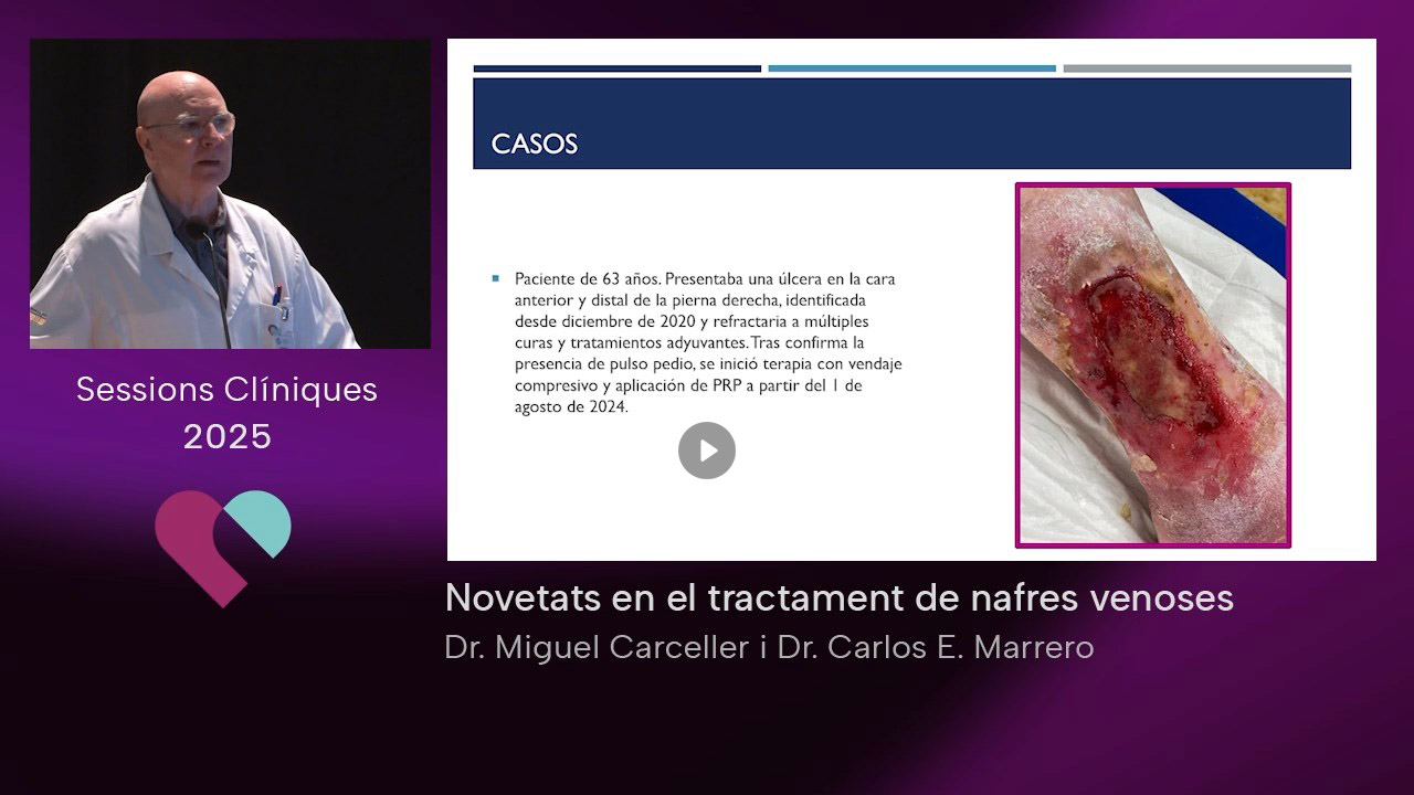 SC - 06 Tractament de nafres - Videoteca IP